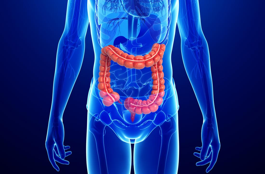 What Makes Ulcerative Colitis So Deadly